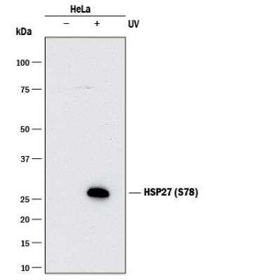 HSP27 [p Ser78] Antibody (2079A) - Azide and BSA Free (MAB9355): Novus ...
